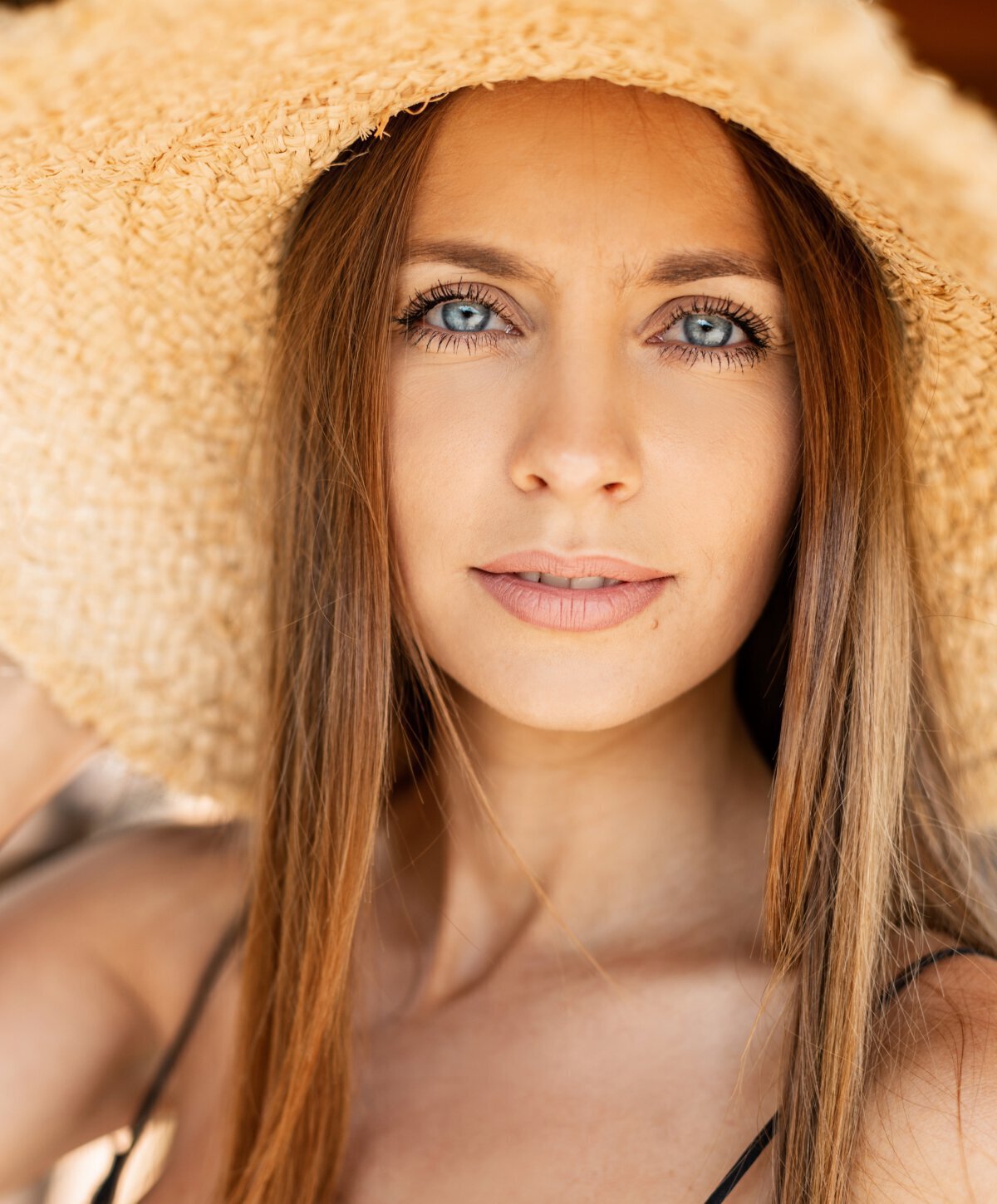 vivace-microneedling-palo-alto-vivace-microneedling-san-jose